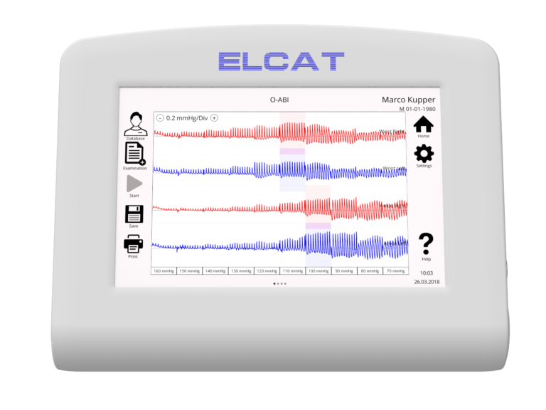 unidirektionaler Taschendoppler | Ultraschall